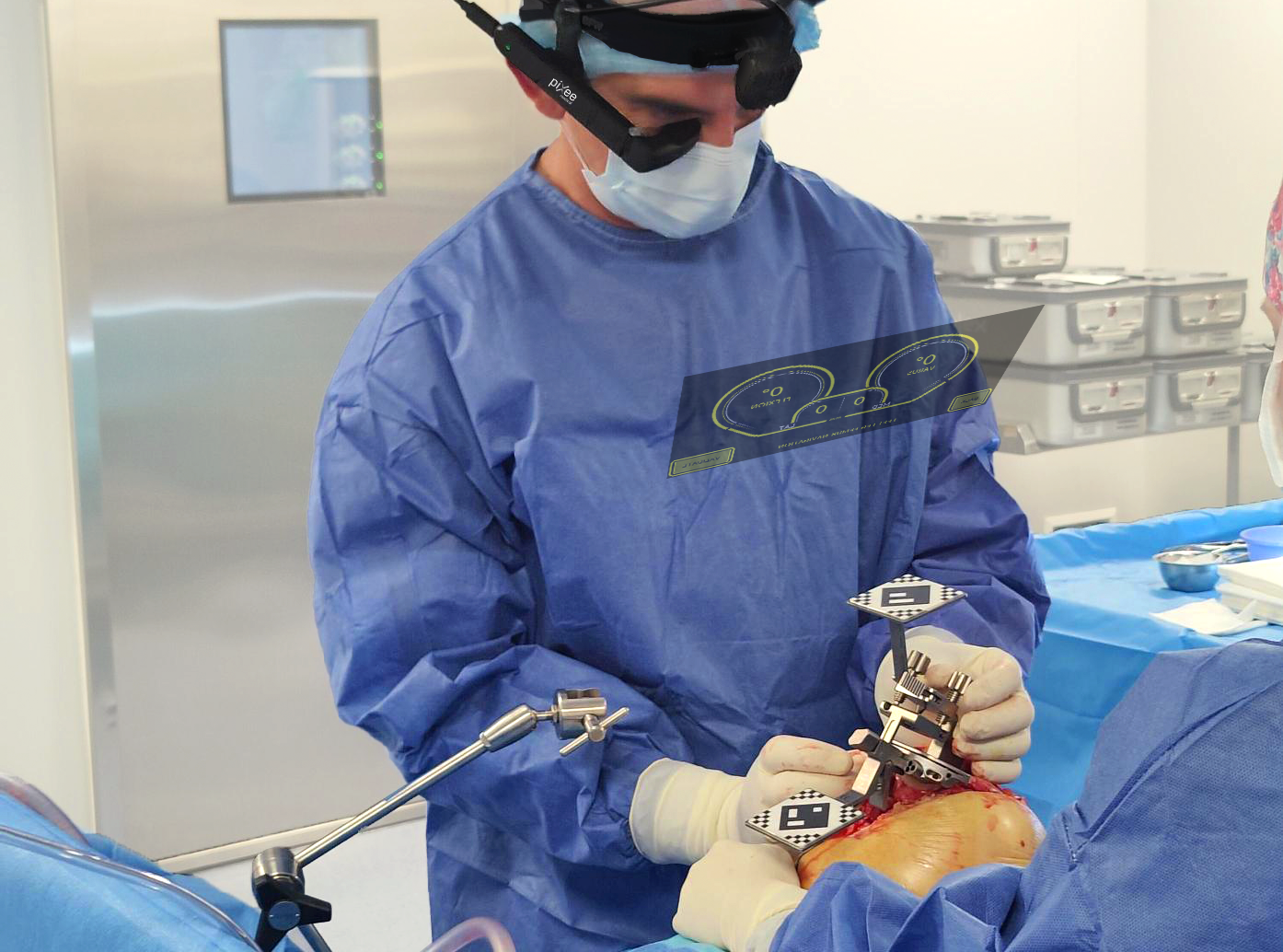 Pixee Medical fait du genou au marché américain | CFNEWS