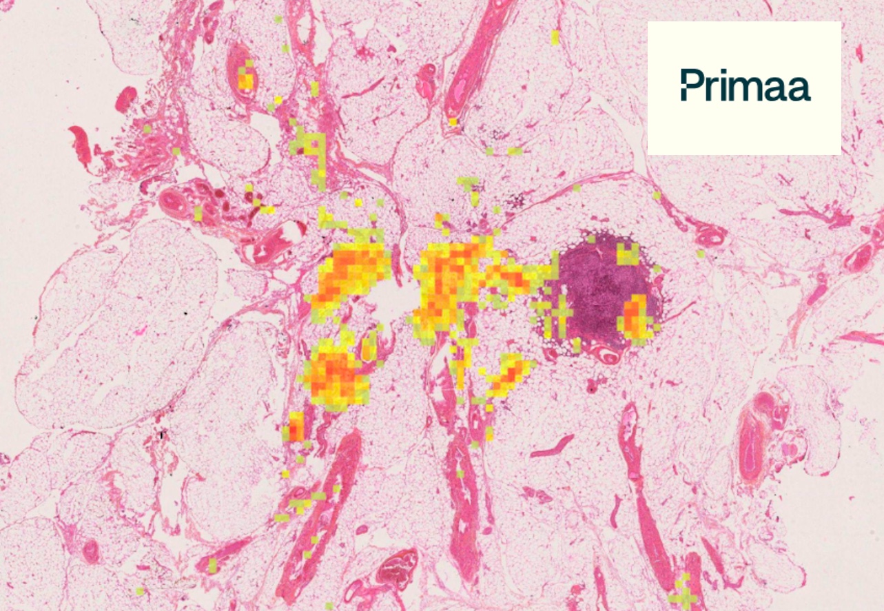 Primaa détecte des business angels | CFNEWS