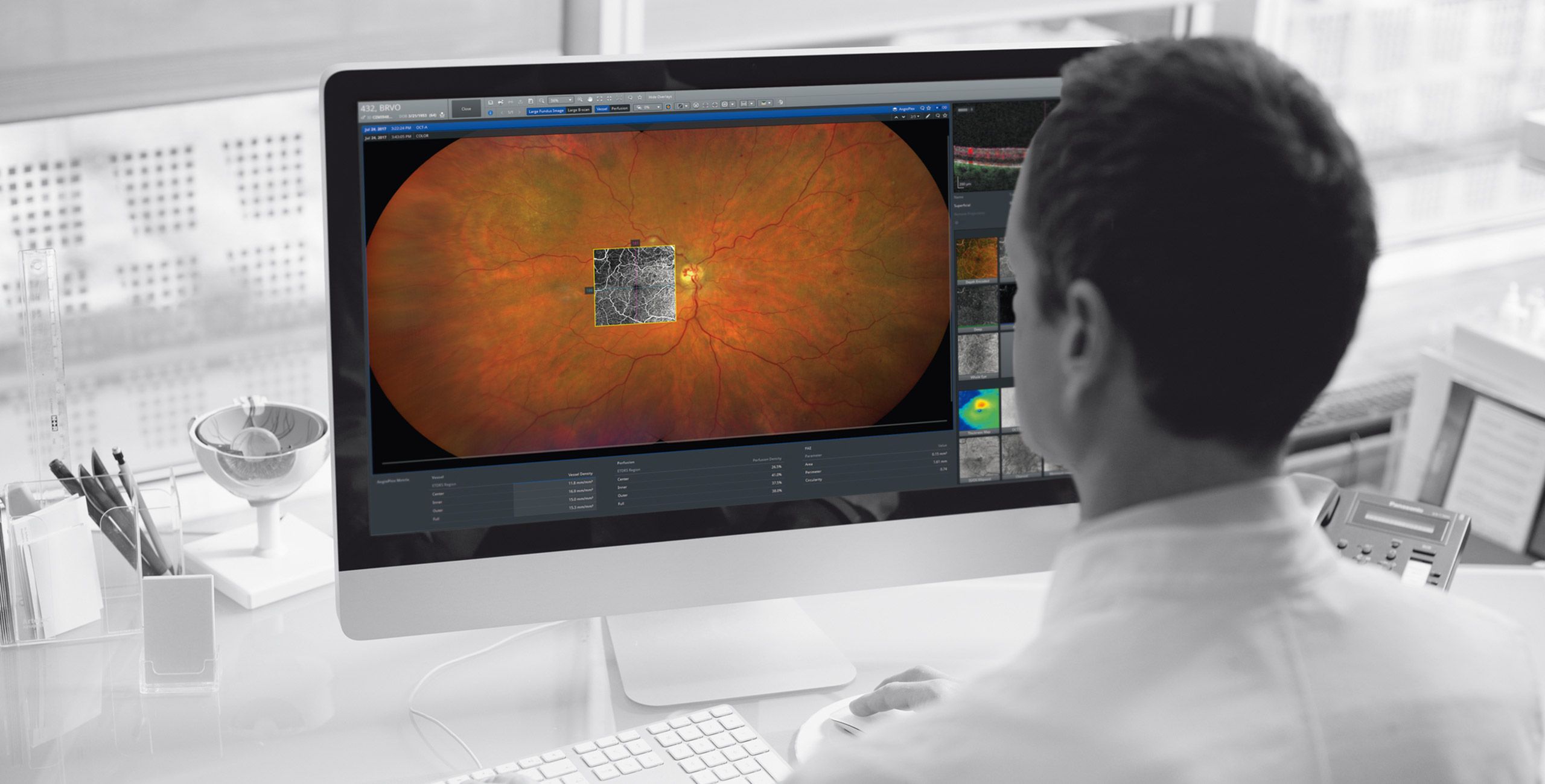 Retinax écarquille son capital | CFNEWS